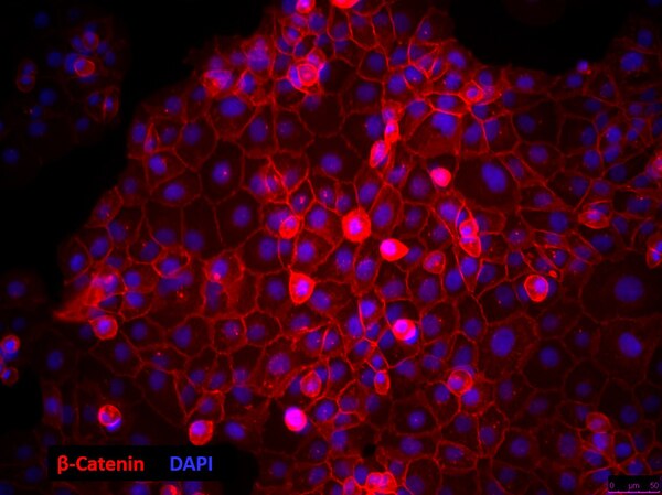 SQ-20B Human Squamous Cell Carcinoma Cell Line | SCC287